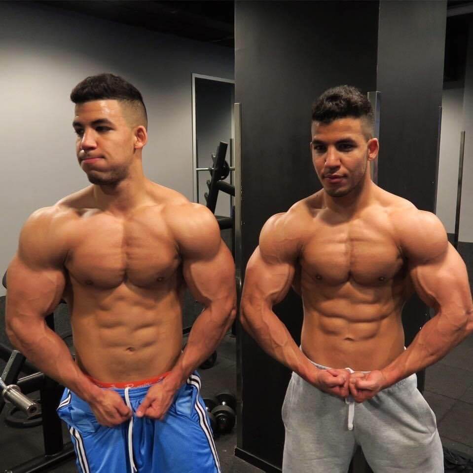 Bodybuilding Twins: Dentists Put a Smile on the Face of the Nation